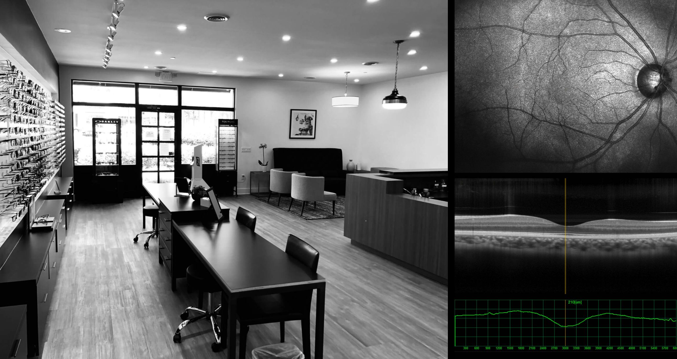 Johns Creek Eyecare | Optometrist | Eyeware & Eye Care | Johns Creek